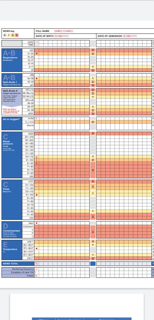 National Early Warning Score – Osce Sense